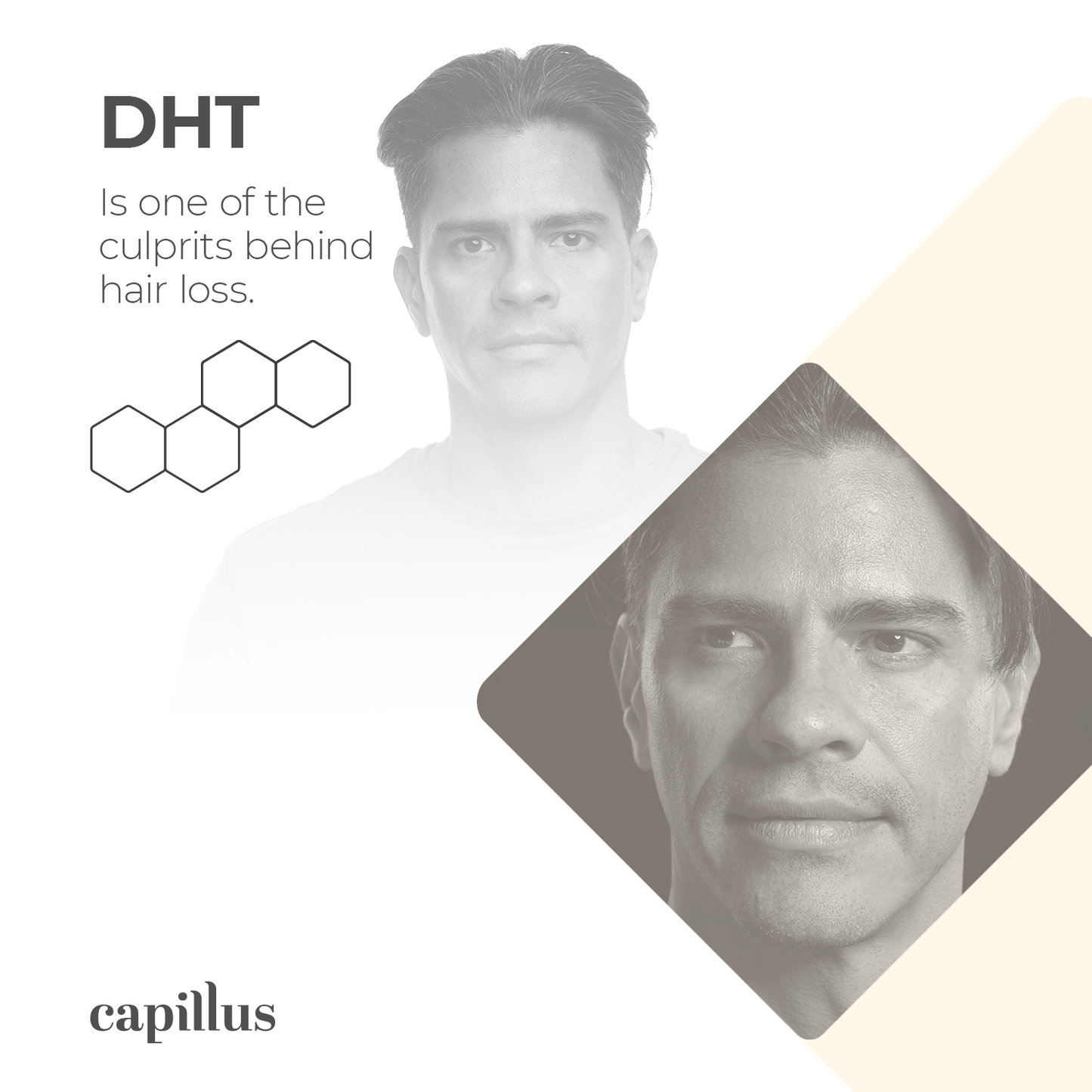 Capillus DHT Blocker Tablet: Supplement for Hair Growth to Combine with ...