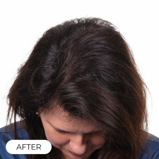 Capillus Plus Laser Cap for Hair Growth