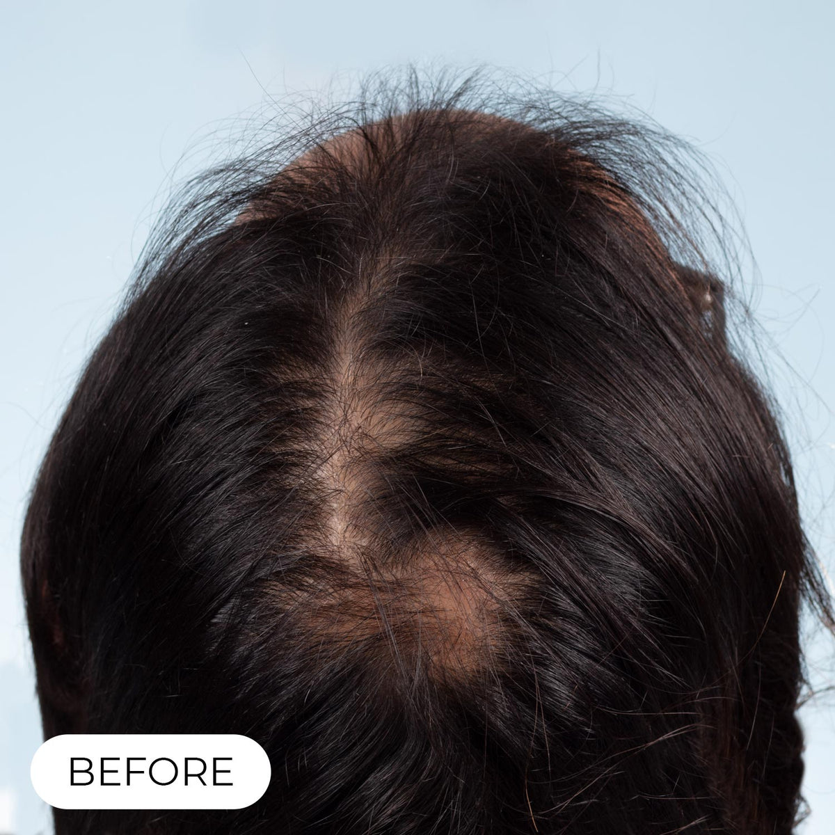 Capillus Plus Laser Cap for Hair Growth