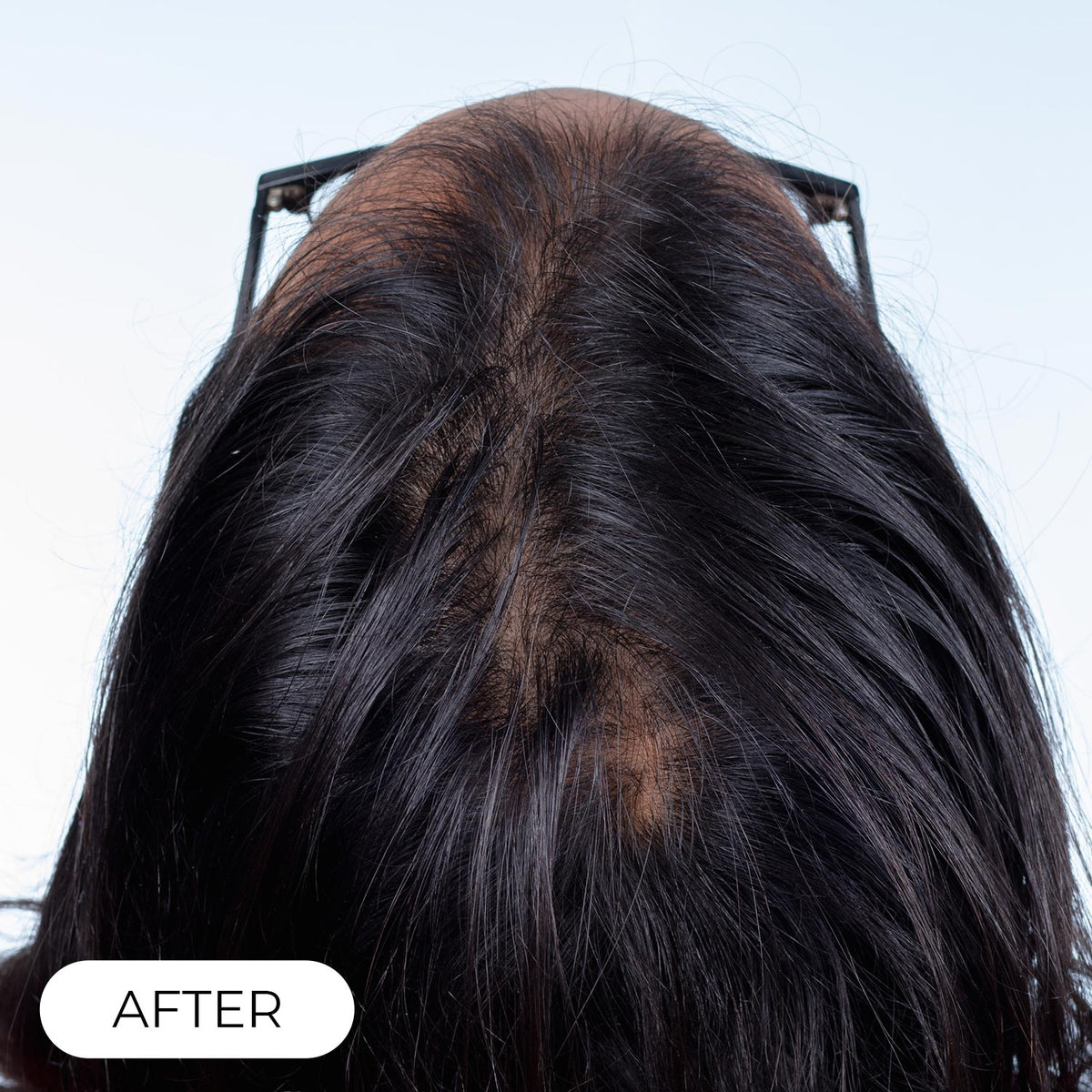 Capillus Plus Laser Cap for Hair Growth