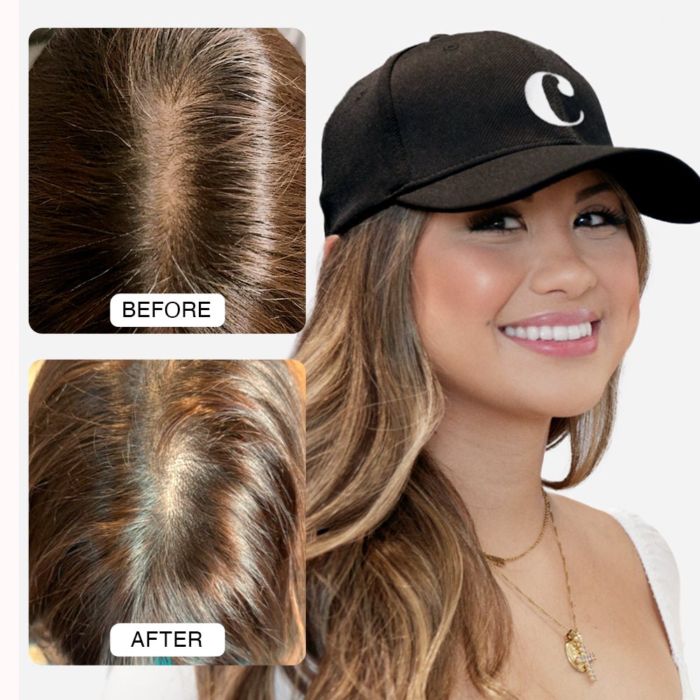 Laser Caps for Hair Growth - Combat the Hair Loss with Capillus Hats