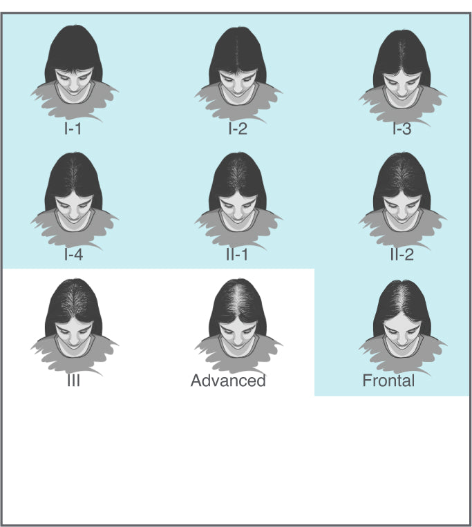 Laser Caps for Hair Growth - Combat the Hair Loss with Capillus Hats