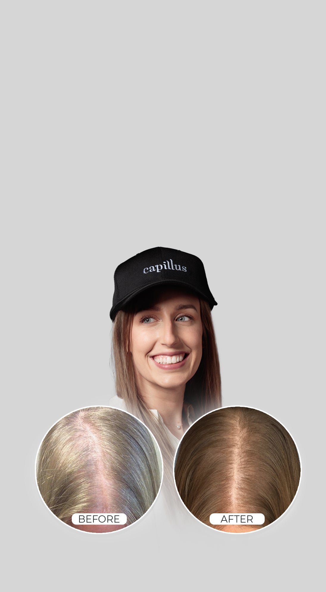Laser Cap for Hair Growth: Stop the Hair Loss with Capillus Hat - Best ...