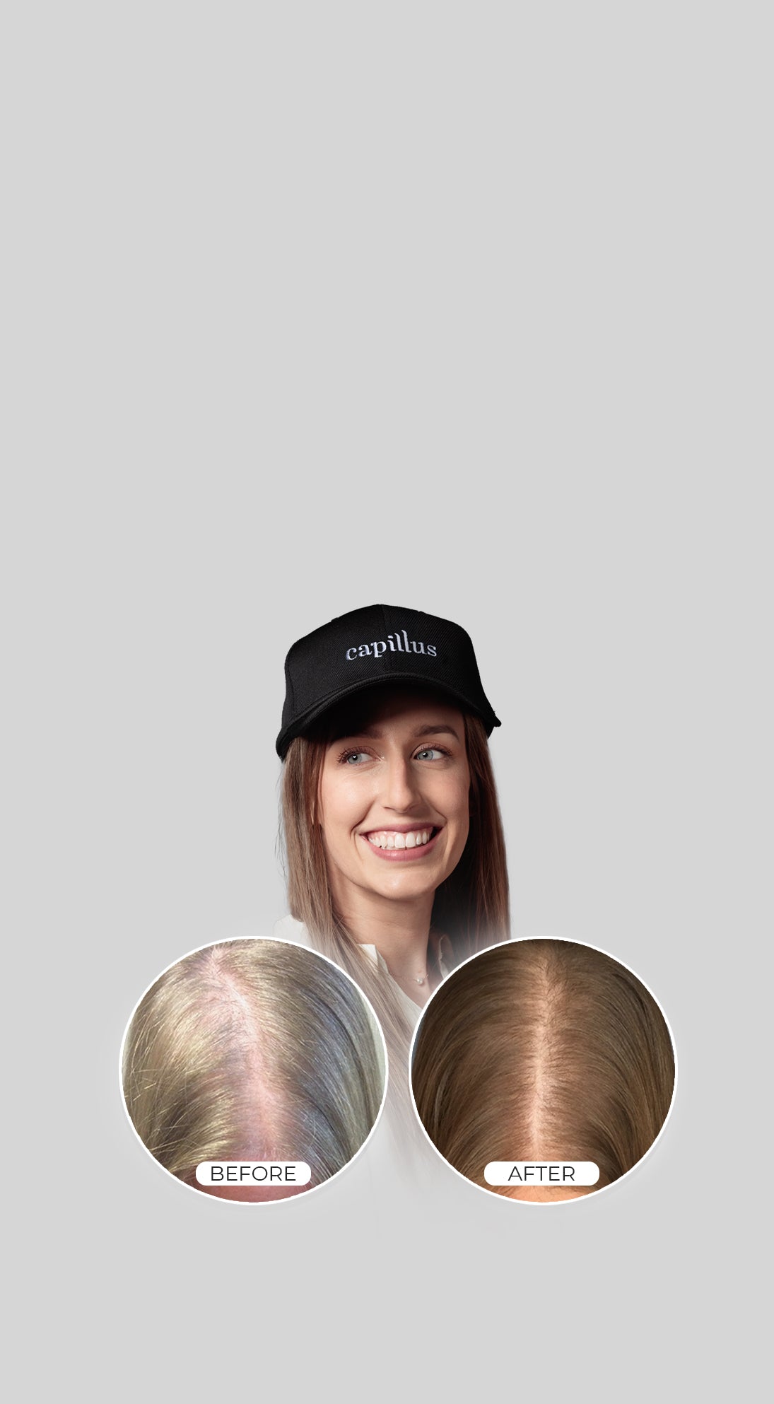Laser Cap for Hair Growth: Stop the Hair Loss with Capillus Hat - Best ...