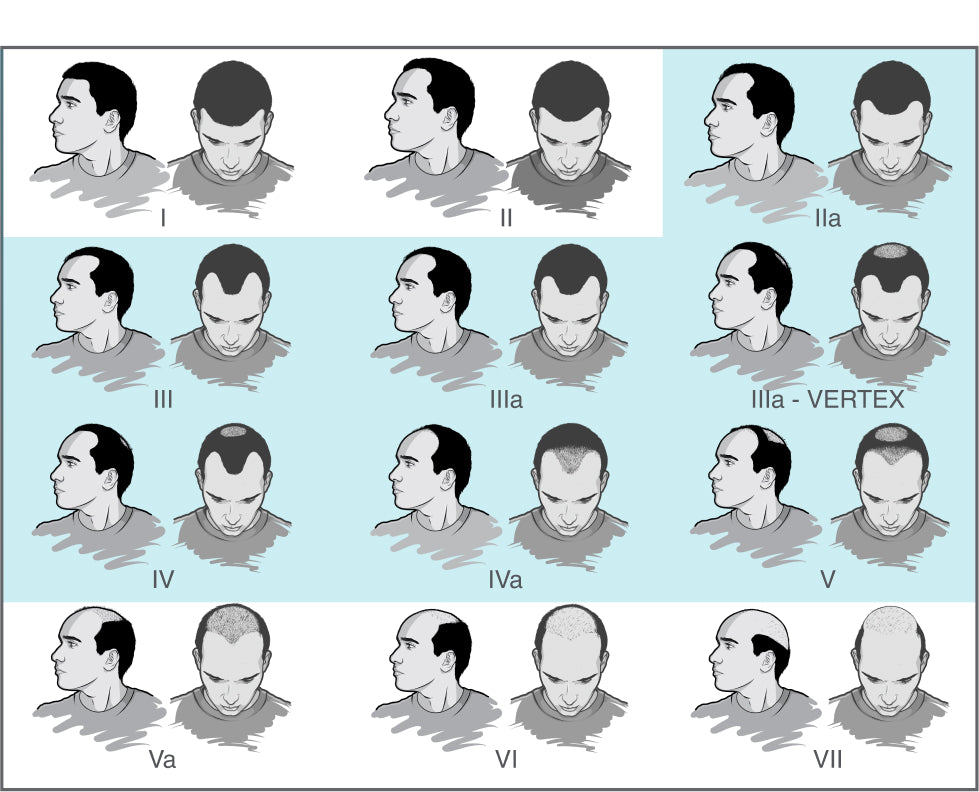Laser Caps for Hair Growth - Combat the Hair Loss with Capillus Hats