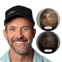 CapillusPro Hair Regrowth Laser Cap